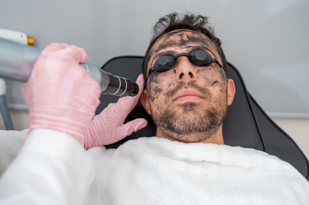 Why the “Hollywood Laser Peel” Is Going Viral - Lakeland, FL | Ageless ...